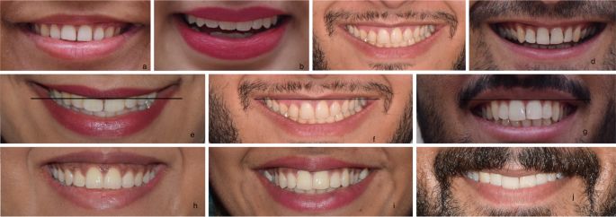 smile detector Object Detection Dataset by smile