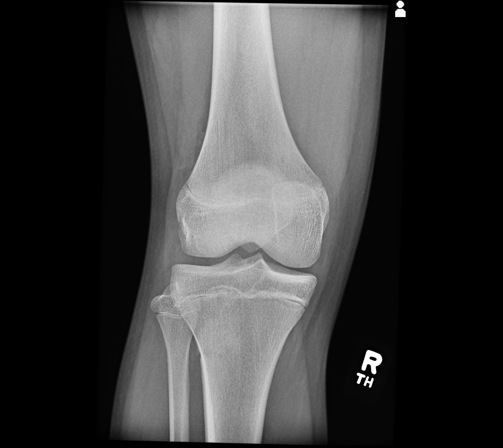 AI Knee Object Detection Dataset by Knee