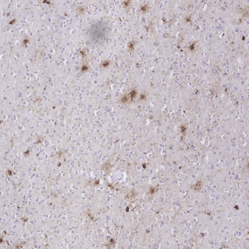 Custom Workflow Single-label Classification Classification Dataset and Pre-Trained Model by ...