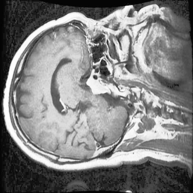 Tuotak Object Detection Dataset By Pfe