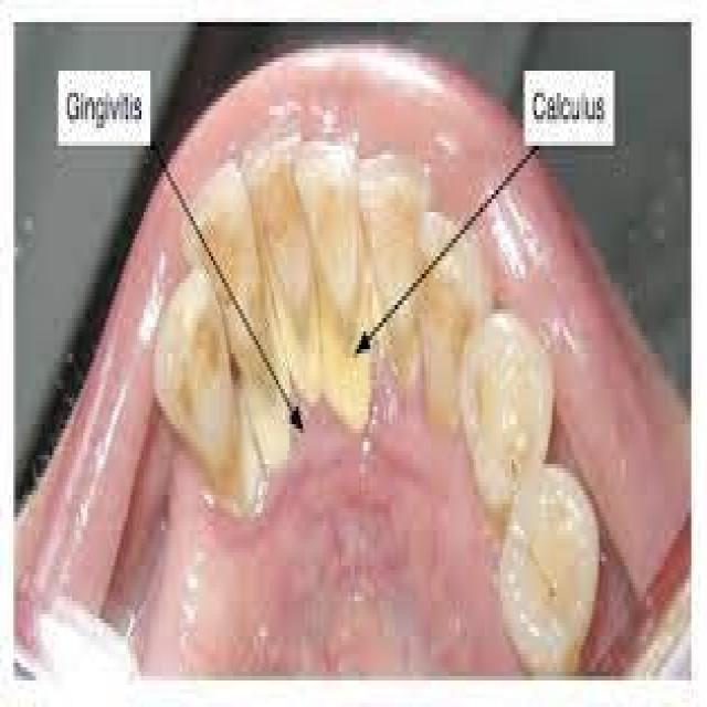 final_dental Object Detection Model by fff