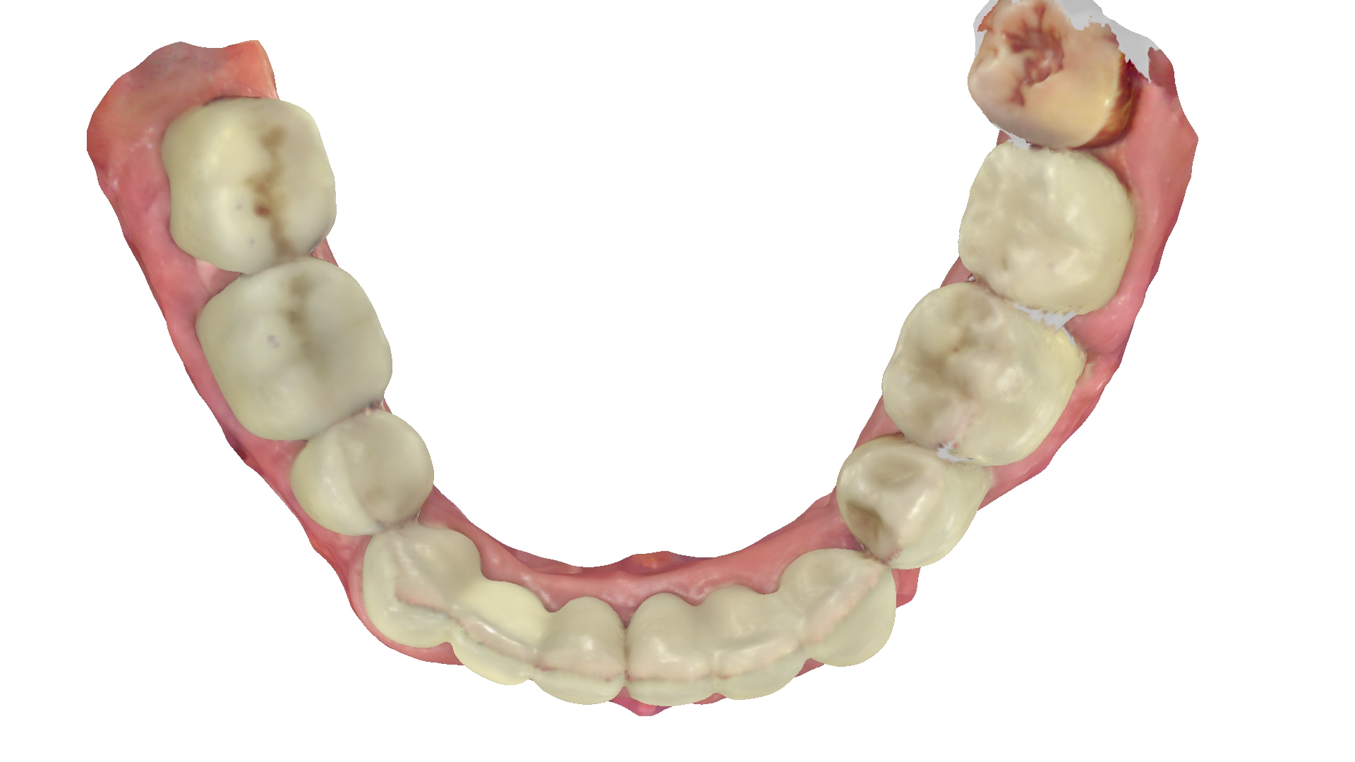 Lower Intraoral Tooth Numbering Object Detection Model by DentalMate6v