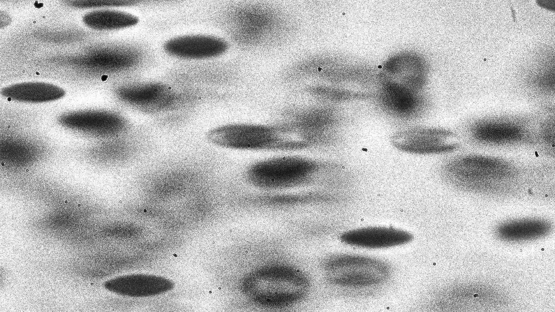 Sickle Cell Detection Object Detection Dataset and Pre-Trained Model by ML Project