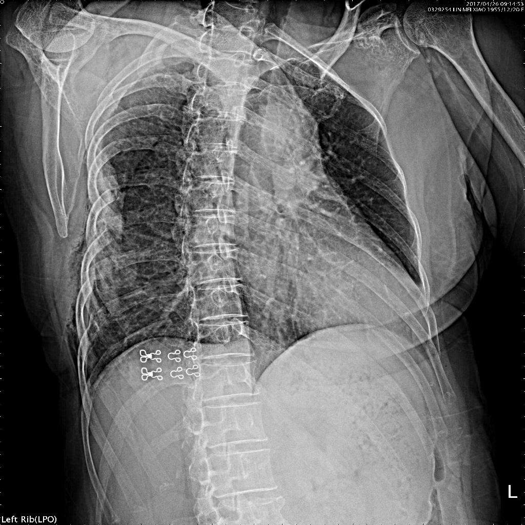 CellAI Classification Model by Prueba 1