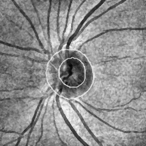 First (first-grgrh) - Roboflow Universe