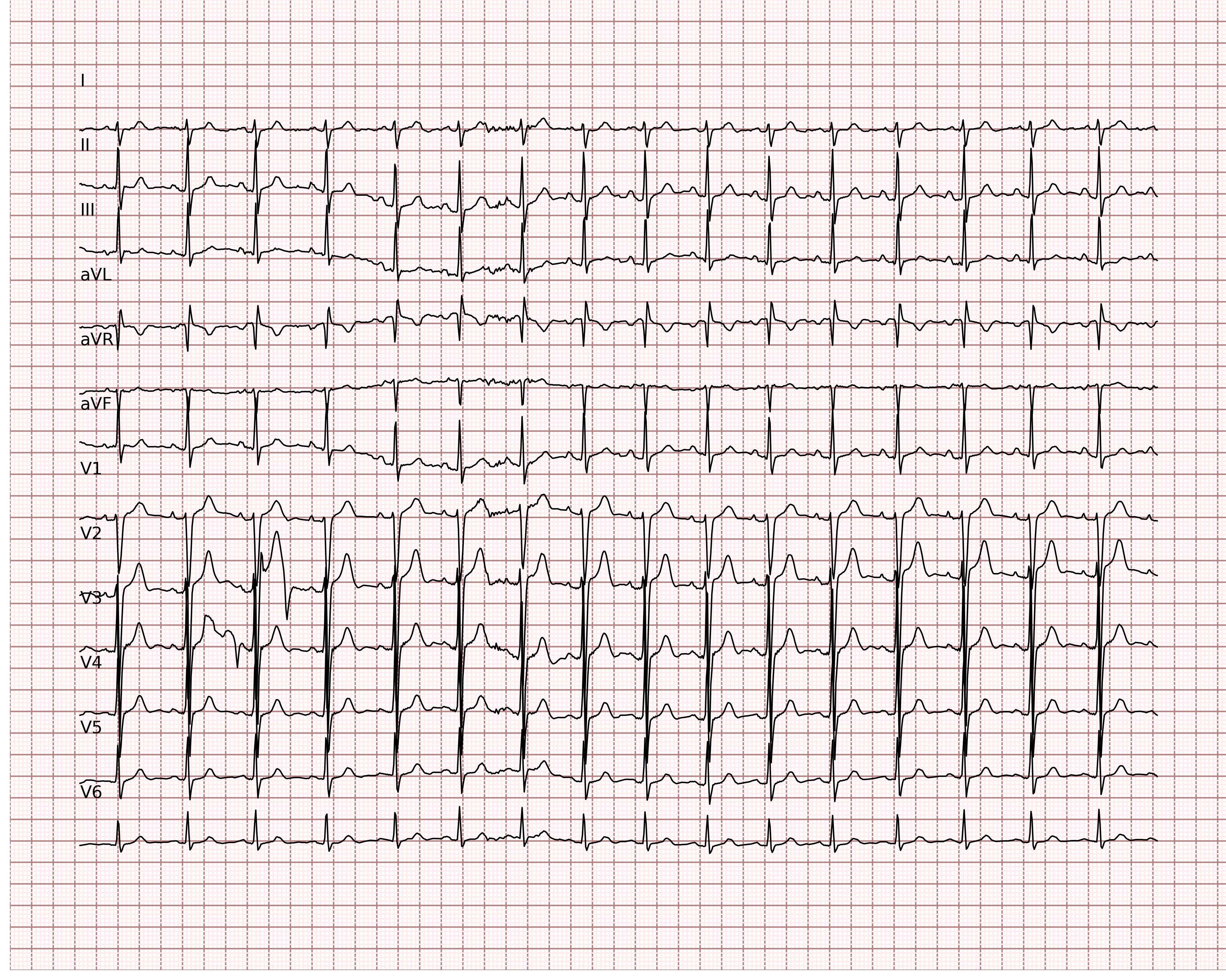 ecg-test Instance Segmentation Dataset by testingecg