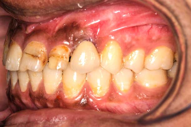 Custom Workflow Single-label Classification Classification Dataset by ShakurWorkspace