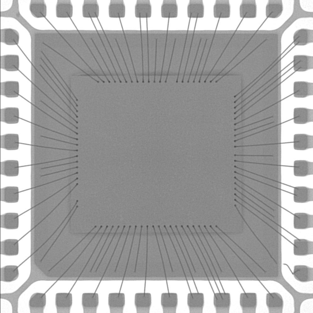 Wire X-Ray 2 Classification Model by Wire XRay