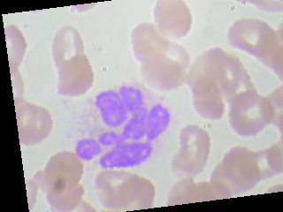 wbc subtypes Object Detection Dataset by Joydip Sarkar