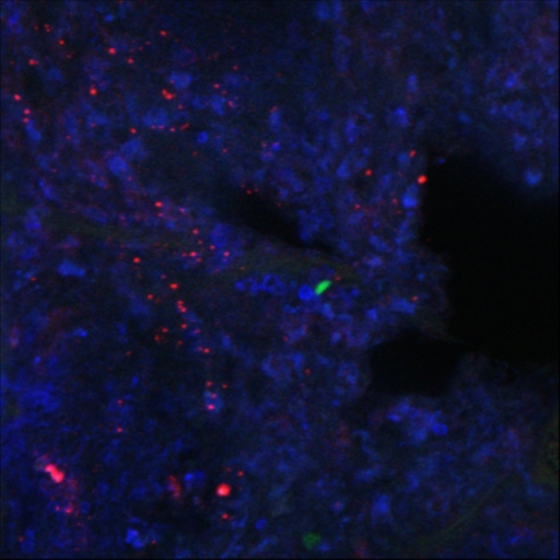 Splenic infection Instance Segmentation Dataset and Pre-Trained Model by IVM
