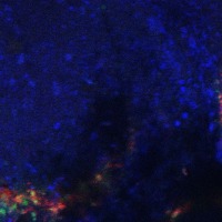 Splenic infection Instance Segmentation Dataset and Pre-Trained Model by IVM