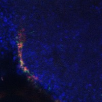 Splenic infection Instance Segmentation Dataset and Pre-Trained Model by IVM