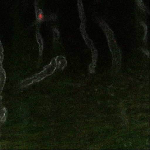 Tumor microenvironment Object Detection Model by IVM