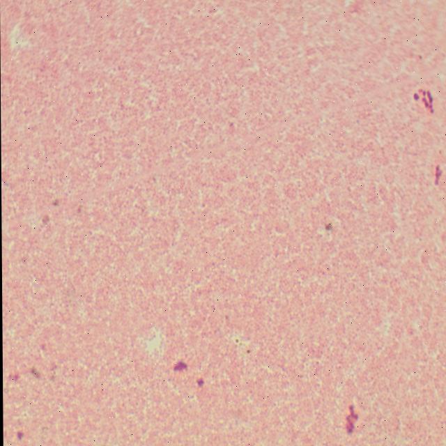 Dataset Augmentation Classification Dataset By Datasetbuilding3