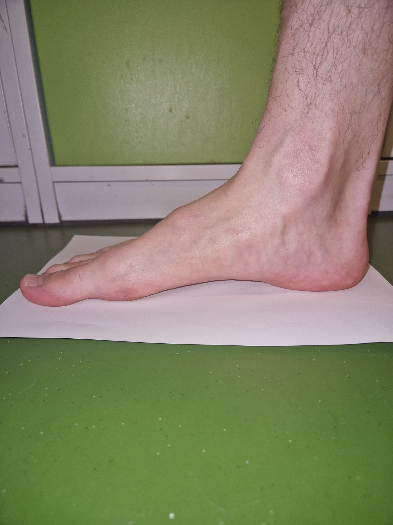 Foot Object Detection Dataset by corrosion Detection