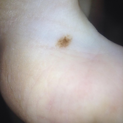 How to Use the Skin diseases Segmentation Instance Segmentation API