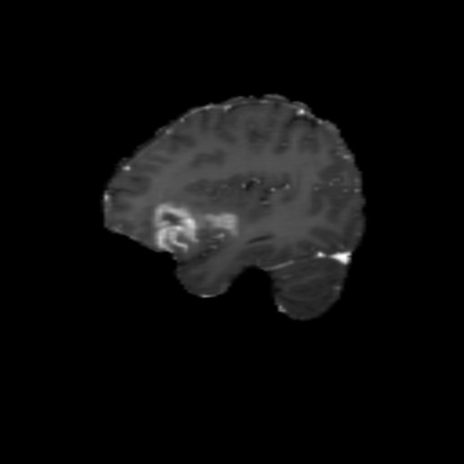 Brain Object Detection Dataset by Ipek Atik