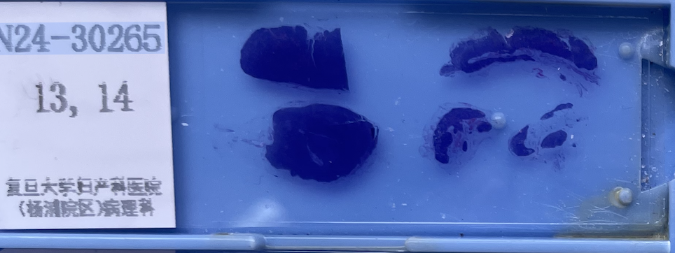 WSI-WAX Instance Segmentation Dataset by workspace