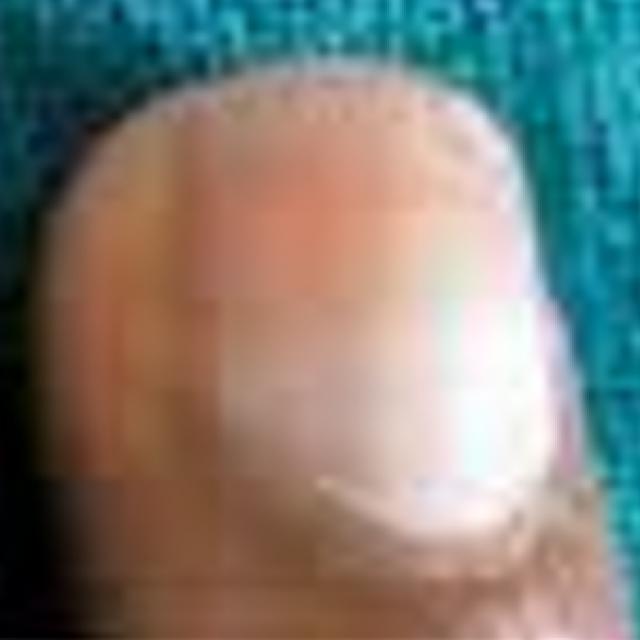 Terry’s nail Object Detection Dataset by MIST