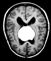 detecting stuff - Roboflow Universe