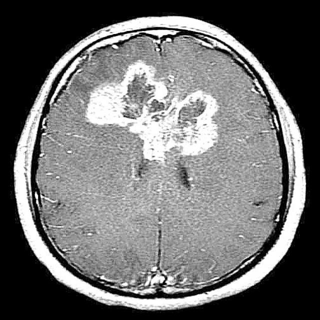 Brain Instance Segmentation Dataset by A