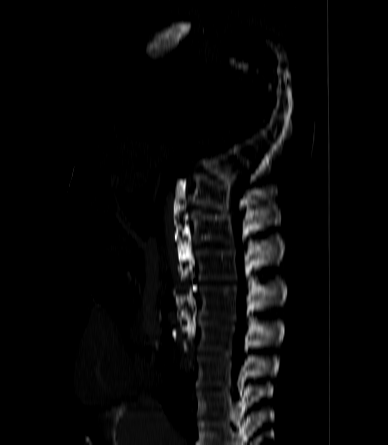 L3_manual_slice_extraction Object Detection Dataset by capstone2024