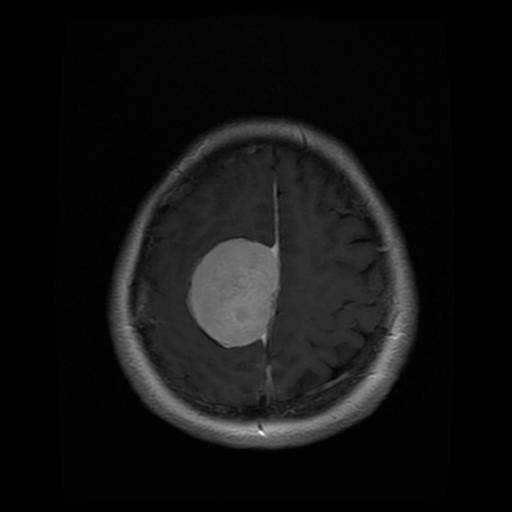 Brain Tumor Detection Object Detection Dataset and Pre-Trained Model by ...