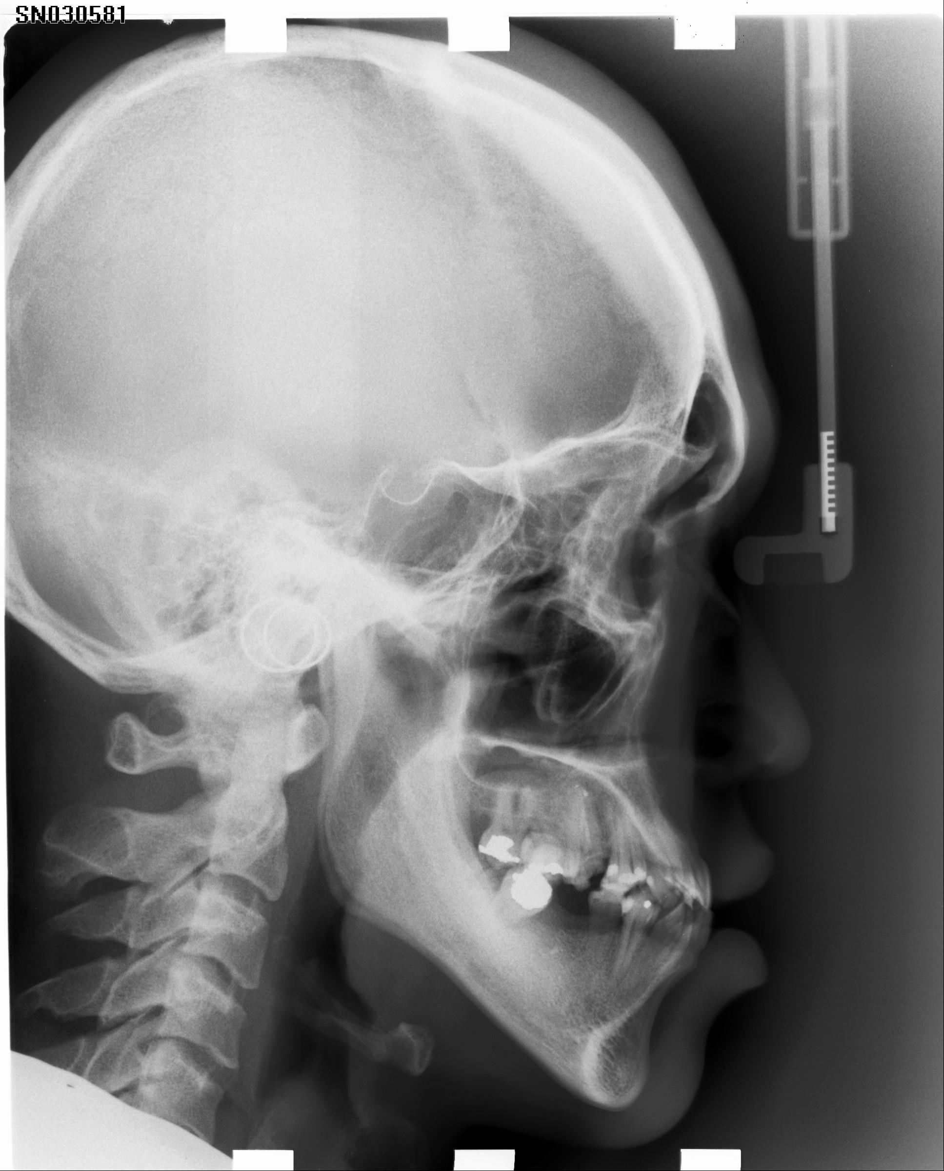 Bardia (bardia-3mkbz) - Roboflow Universe