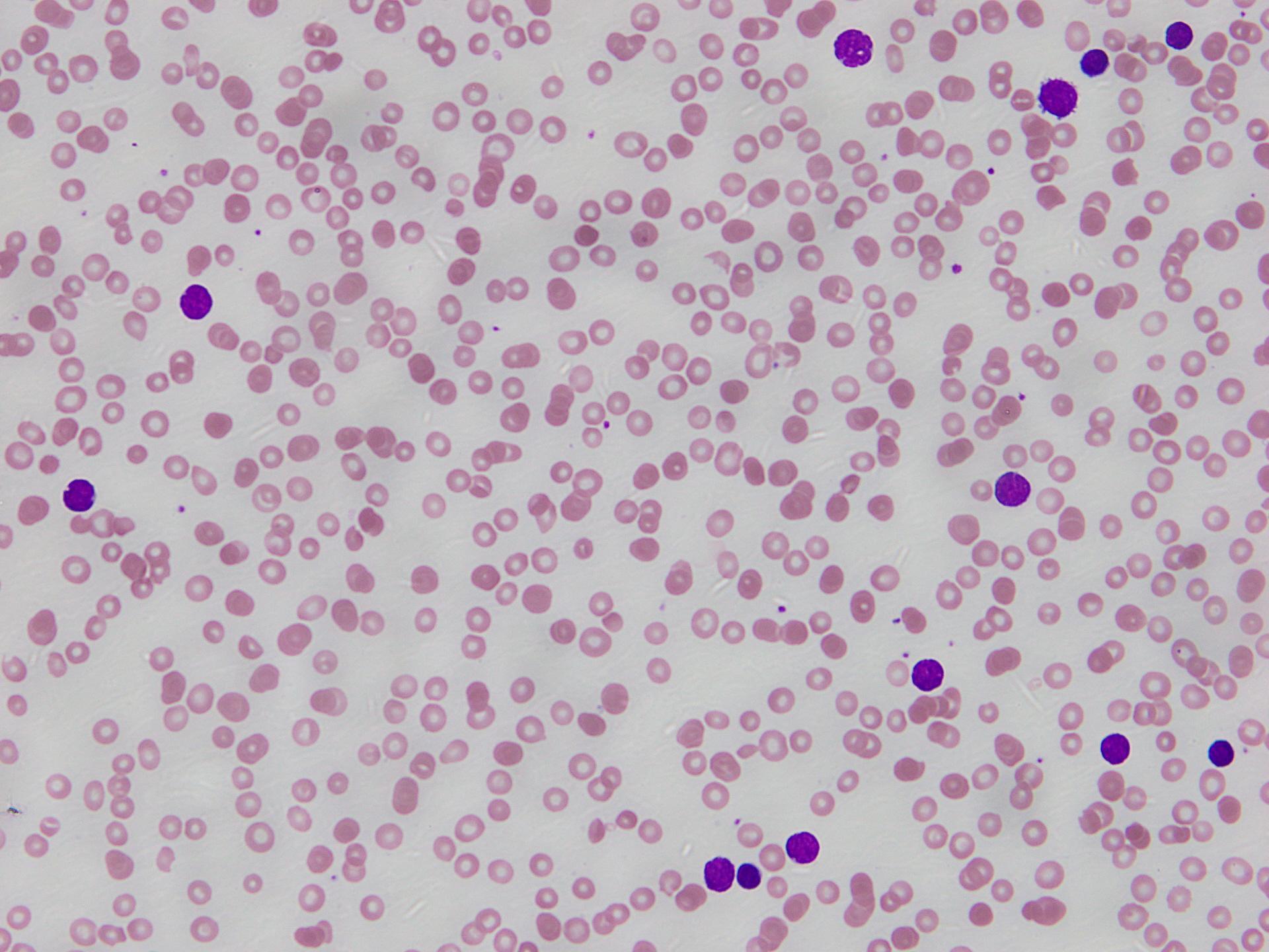 WBC (wbc-2vcms) - Roboflow Universe