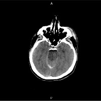 pooja s (pooja-s-uzofx) - Roboflow Universe