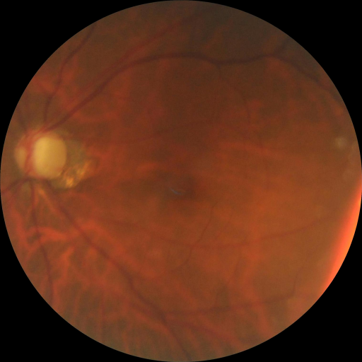 blood vessel segmentation Instance Segmentation Dataset and Pre-Trained ...