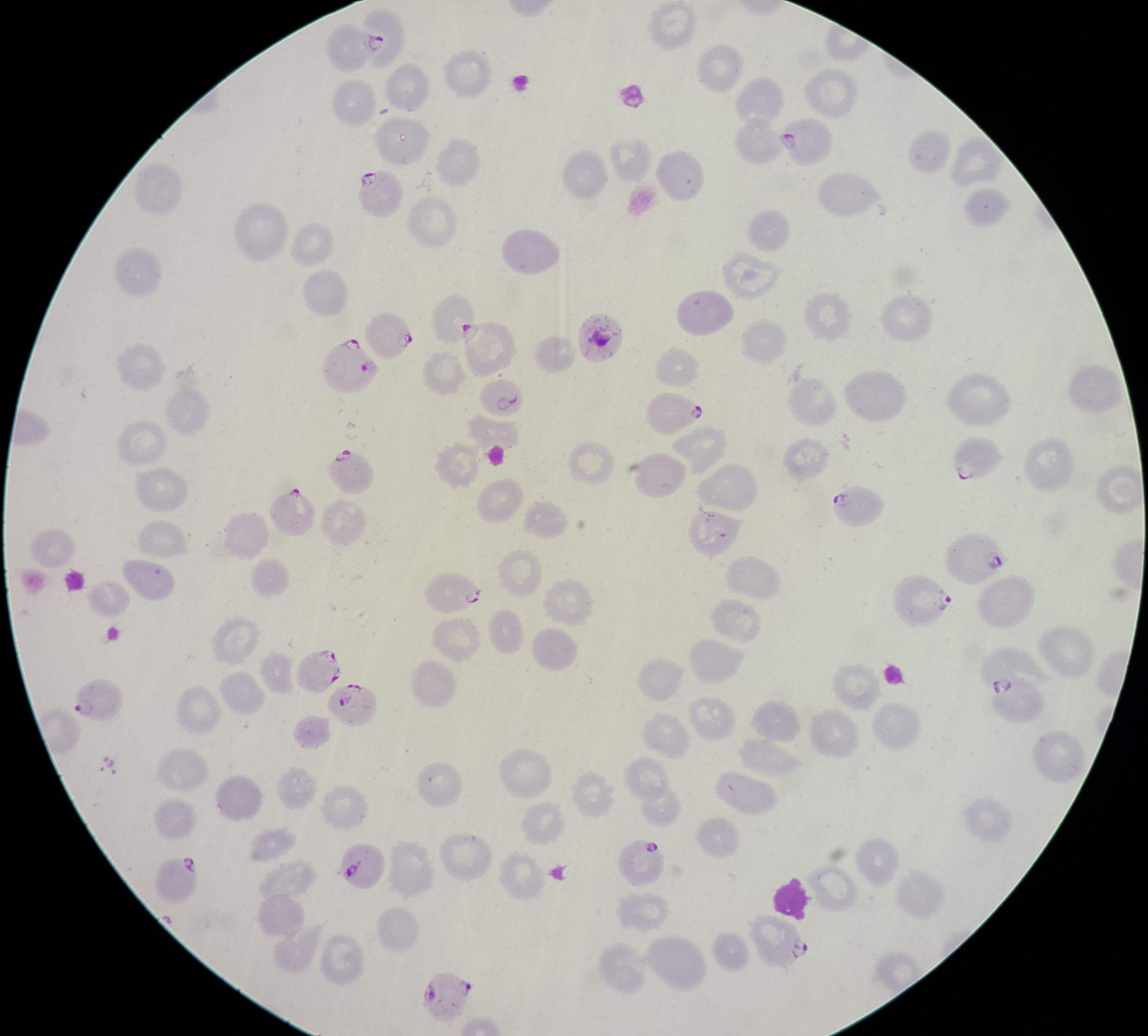 malaria detection system - Roboflow Universe