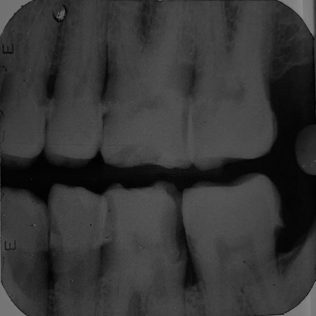 tooth_detection Object Detection Dataset by Thammasat University