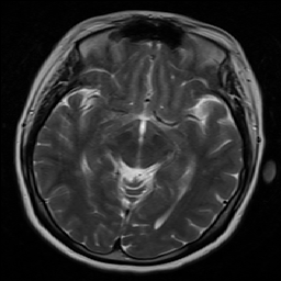 lesions Instance Segmentation Model by E Corp