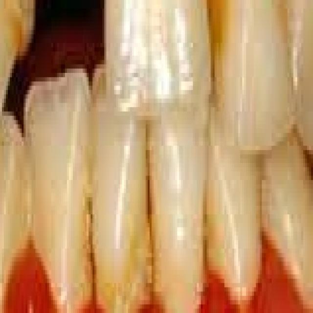 Object Detasadf Object Detection Dataset And Pre Trained Model By Caries