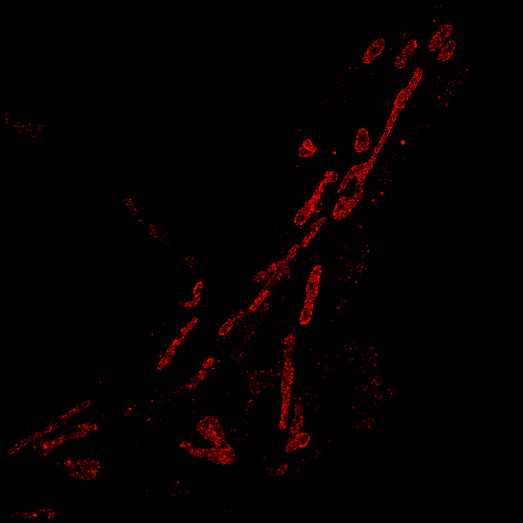 Mitochondria Object Detection Model V1 2022 09 13 3 23pm By Hyu