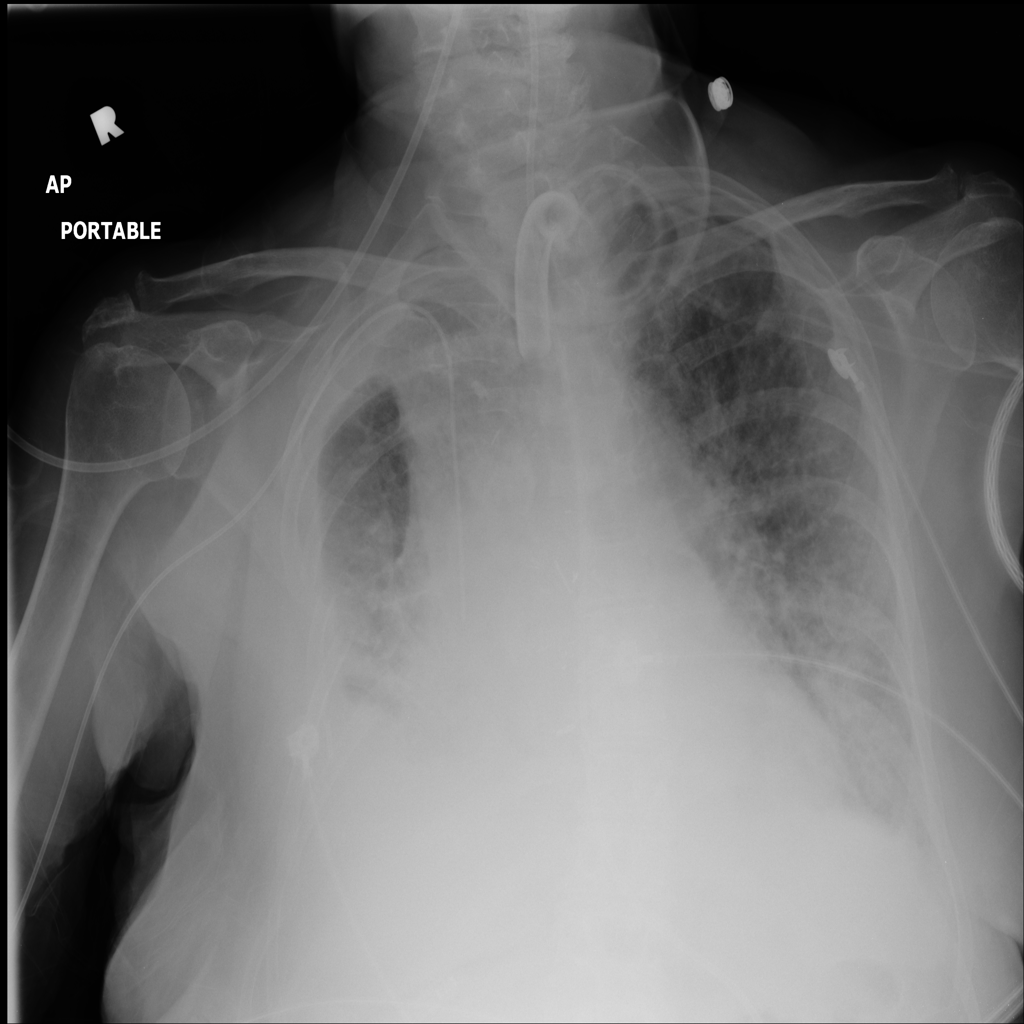 chest imaging Instance Segmentation Dataset by kgall