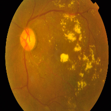 Deep pratap - Roboflow Universe