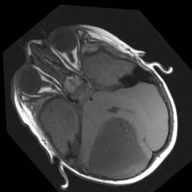 A++ Instance Segmentation Model by S2