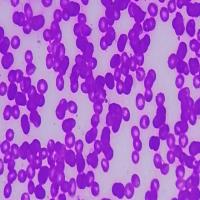 Malaria (malaria-izx8r) - Roboflow Universe