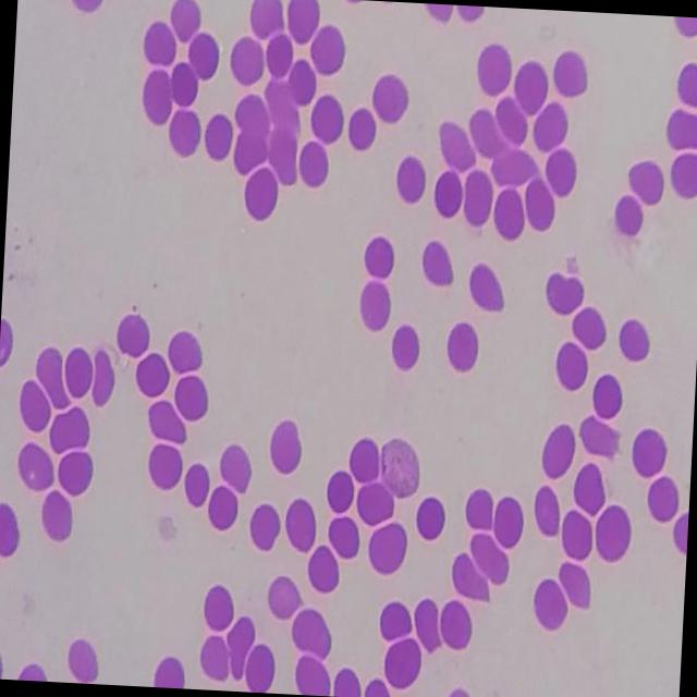 Malaria HCM 400x Modified DS Object Detection Dataset by Malaria