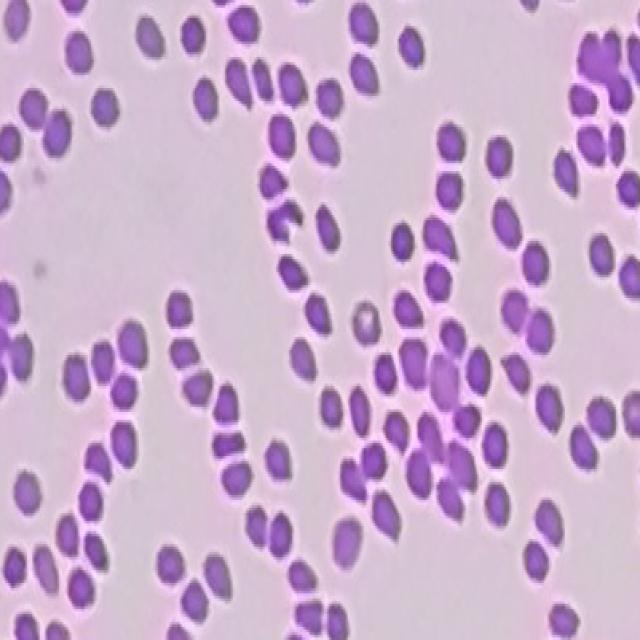 Malaria HCM 100x Object Detection Dataset by Malaria