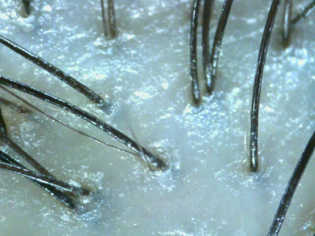 Fu Detection Object Detection Dataset And Pre Trained Model By Tricholapse