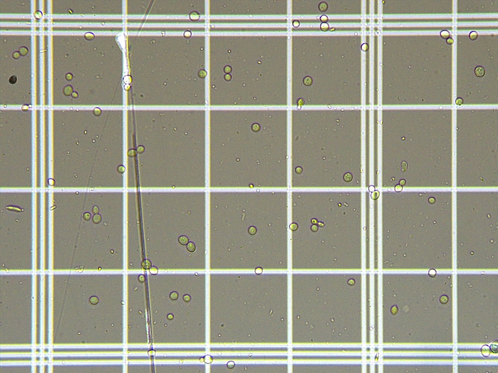 Yeast Box Area Object Detection Dataset And Pre Trained Model By Aiml Cell Yeast Counter