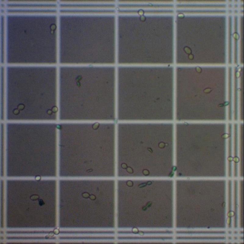 Yeast Improve Accuracy Object Detection Dataset And Pre Trained Model