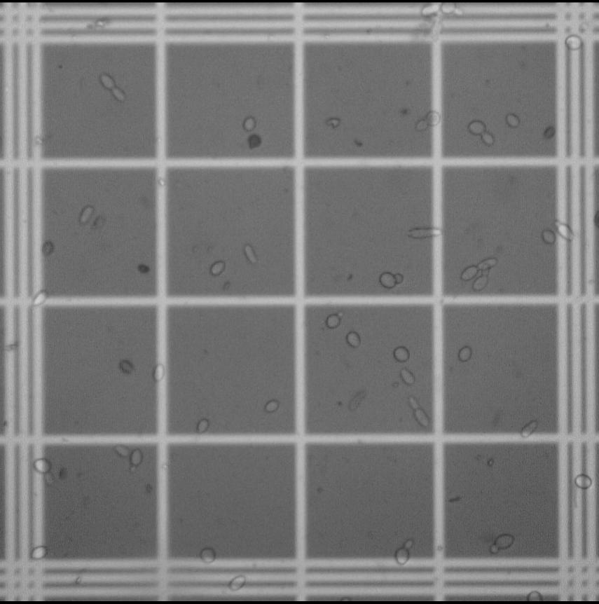 yeast - budding zone Object Detection Model by AIML Cell Yeast Counter