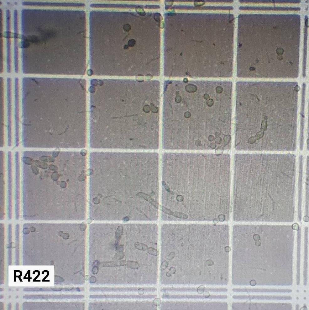 Upsampling Test Classification Dataset By Aiml Cell Yeast Counter