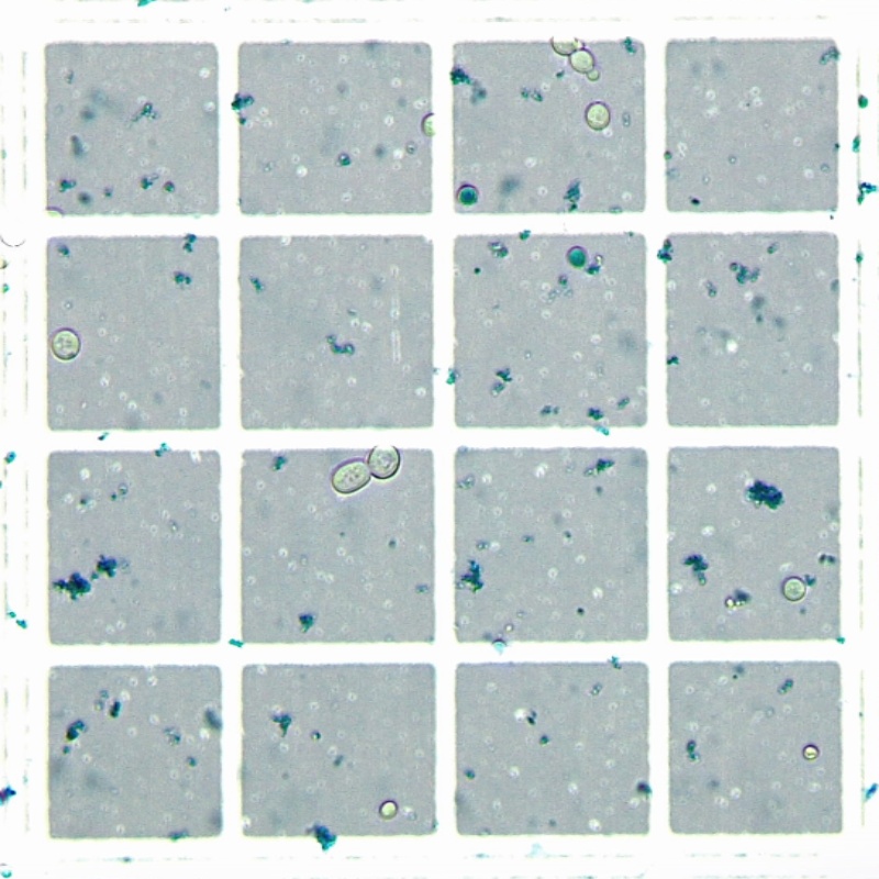 Infectioncell Only Type L Object Detection Dataset And Pre Trained