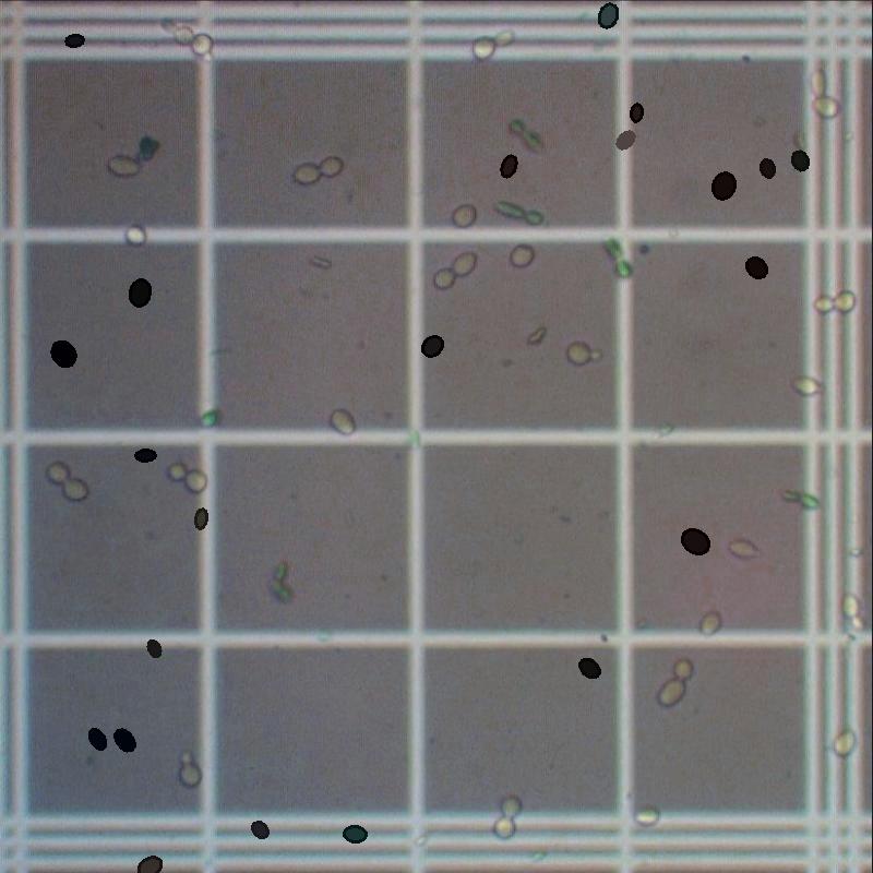 yeast-deadcell Object Detection Model by AIML Cell Yeast Counter
