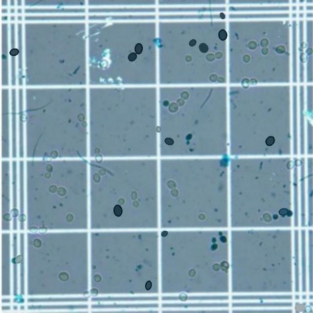 How To Use The Yeast Cell Infection Instance Segmentation Api